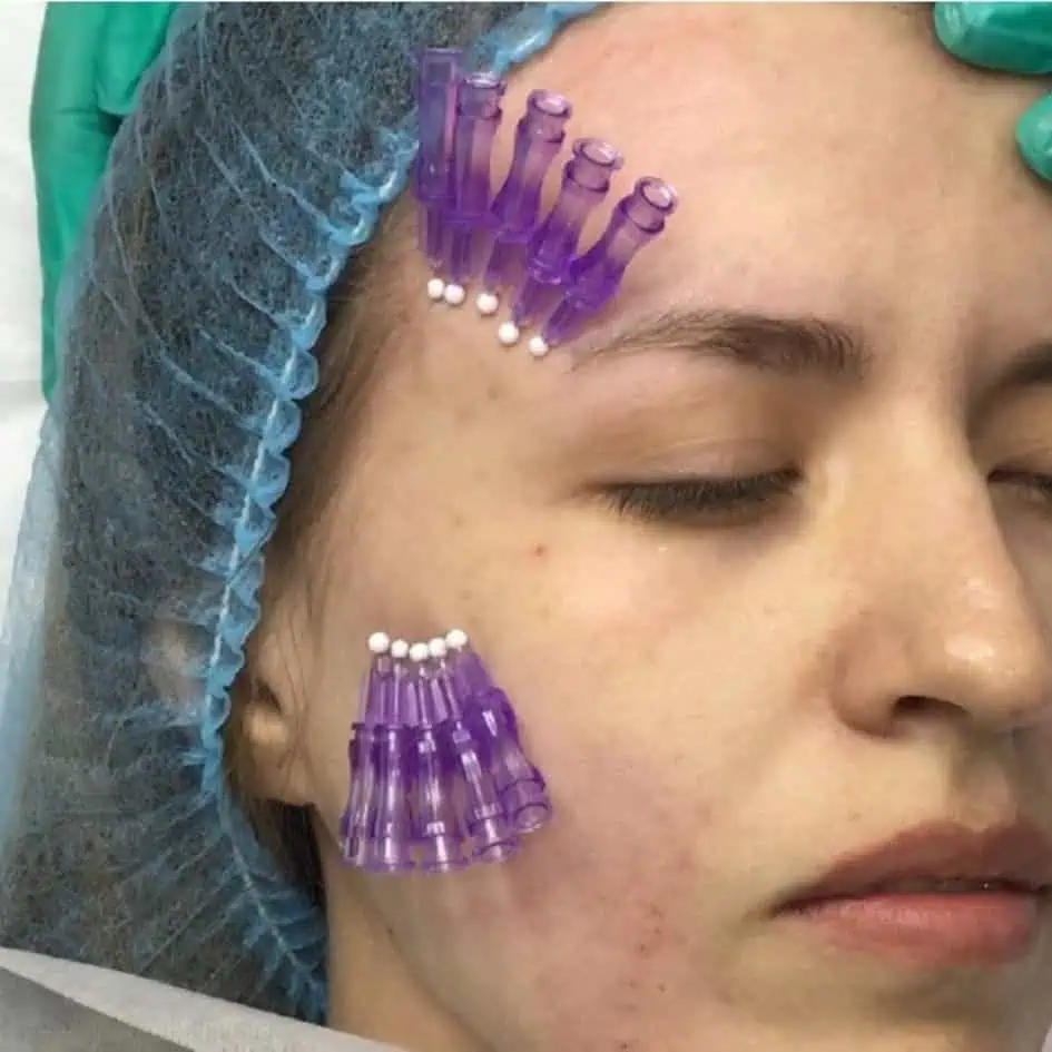 Buy PDO Mono Threads (20ea) Online