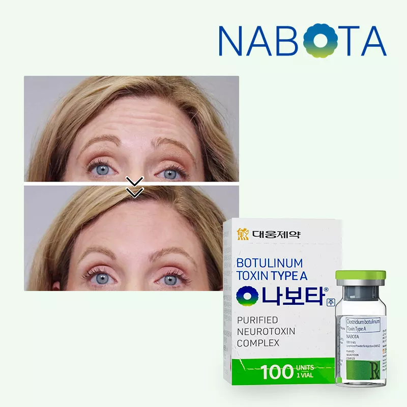 Buy Nabota 100U Online